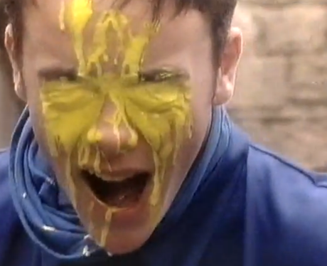 Answer: He was blinded while playing paintball - How Well Do You Know ...